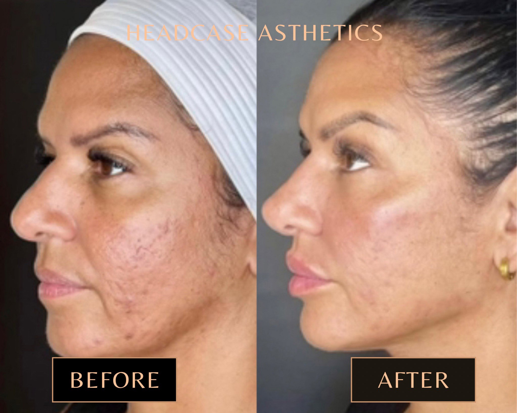 Home | Headcase Aesthetic