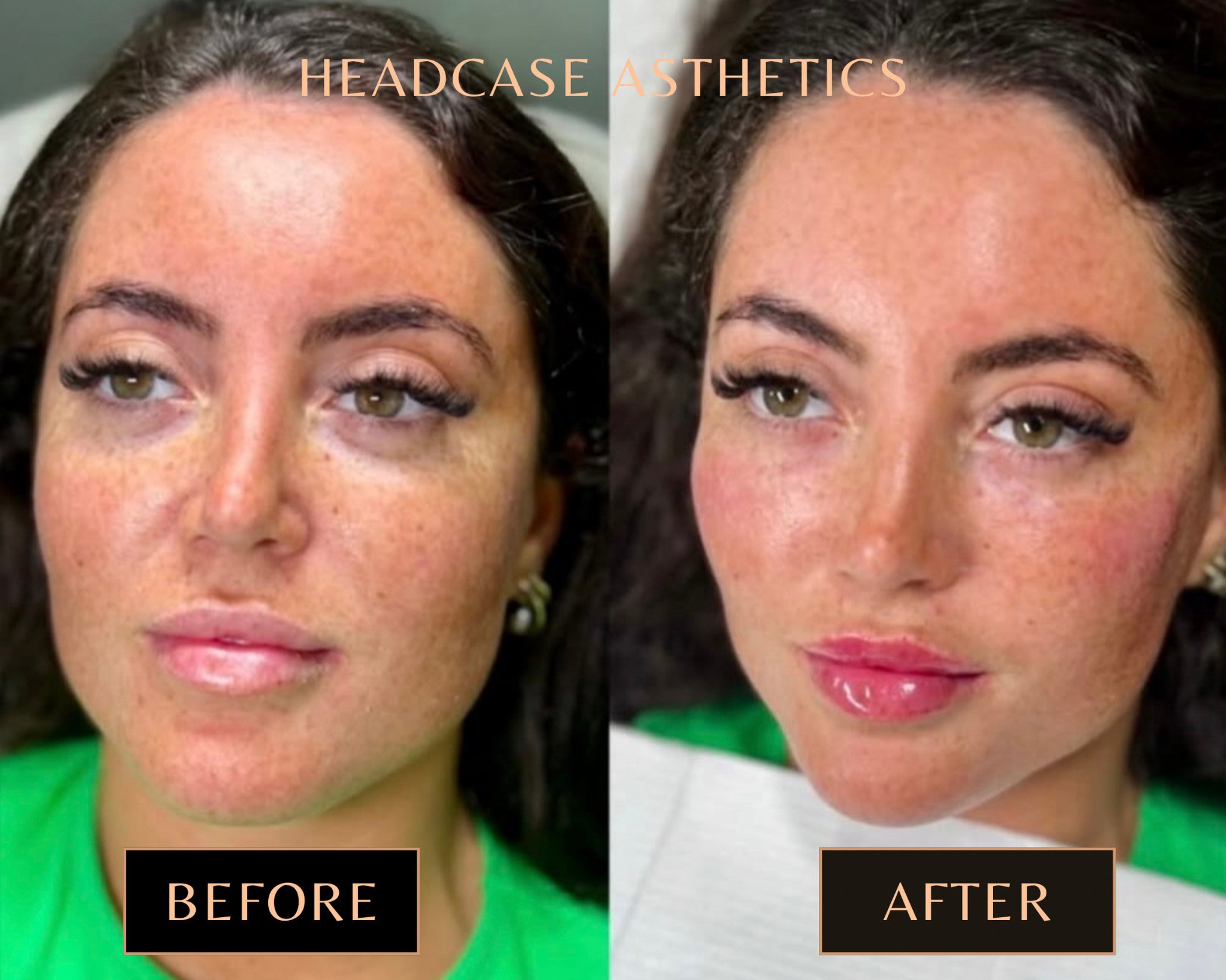 Home | Headcase Aesthetic